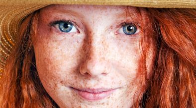 How to check your skin & moles for skin cancer risks – Ginger Parrot