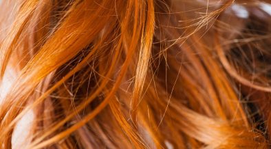 MC1R Ginger Gene Linked To Parkinson’s Disease and Melanoma Risk ...