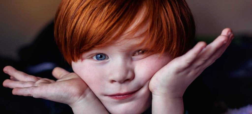 Why is ginger hair so rare? | Ginger Parrot